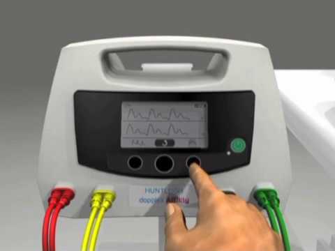 Dopplex ABIlity - Automatic Ankle Brachial Index System - Mains Cable ...